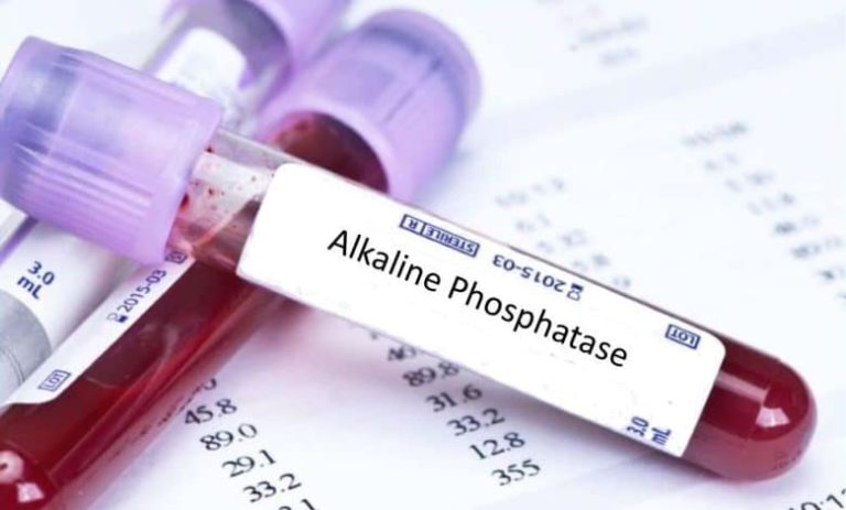 Alkaline Phosphatase در آزمایش خون چیست؟ + تفسیر آزمایش آلکالین فسفاتاز ...